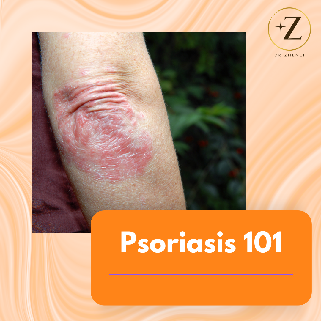 Psoriasis 101 – Dr Kwan Zhenli – Dermatology
